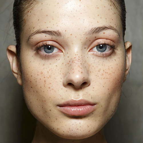 Pecas, tendencia beauty de 2016 | BellezaPura Pecas, tendencia beauty de 2016 | BellezaPura