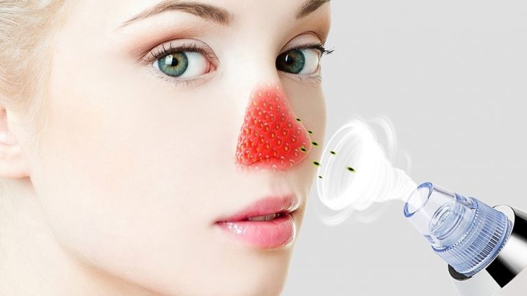 Cómo quitar los granos rojos de acné | BellezaPura