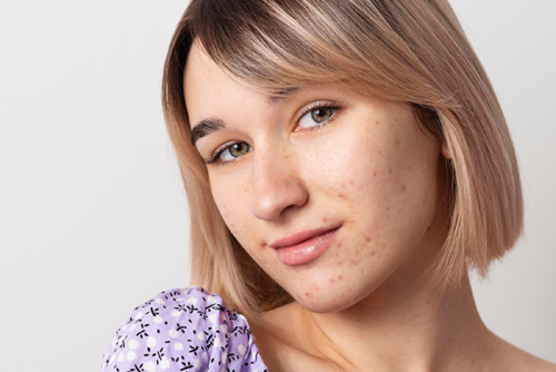 Si tienes la piel asfixiada, toma nota de cómo cuidarla | BellezaPura